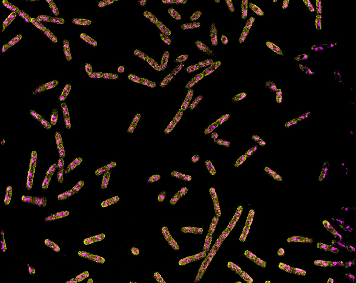 E. coli Membrane and Chromosome - Abbelight