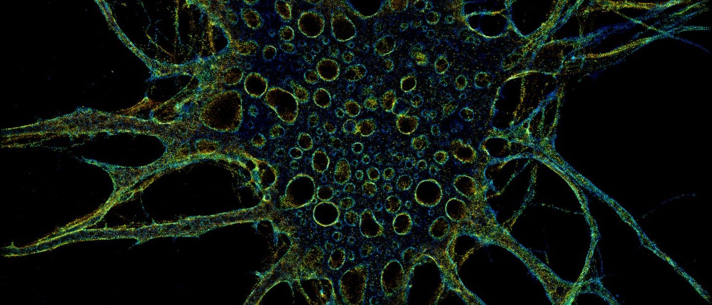 Documentation - Abbelight