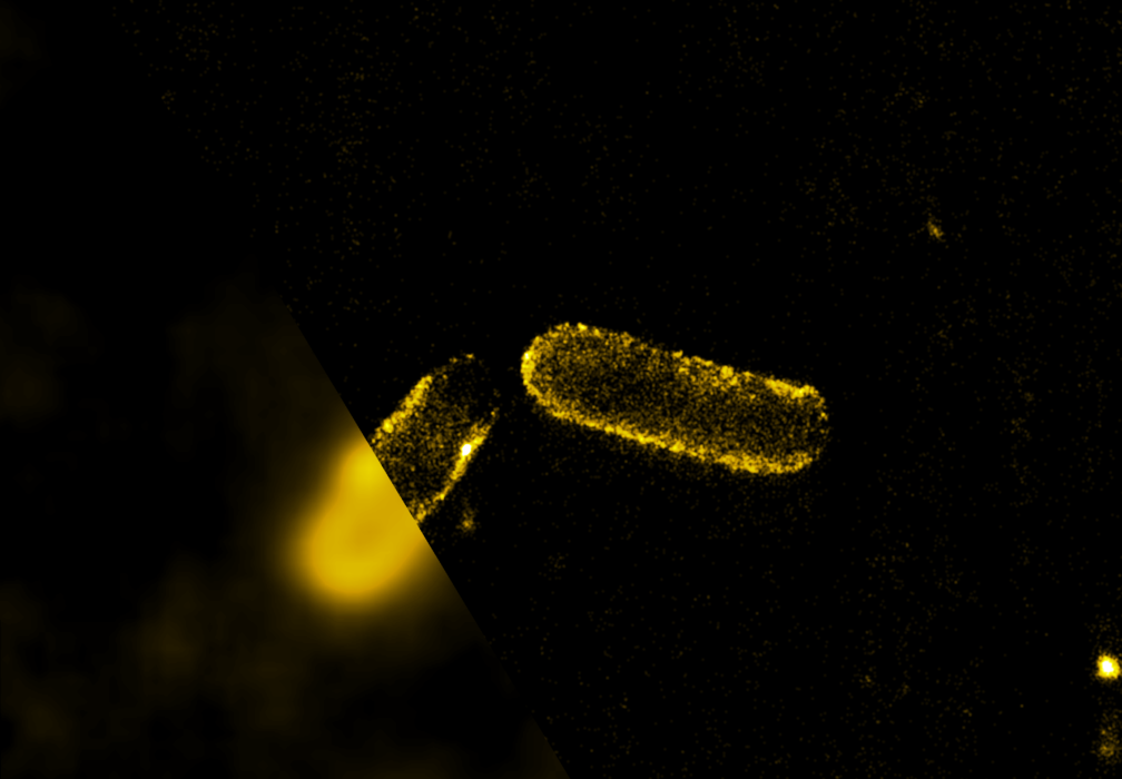 Revealing sophisticated architecture of bacteria - Abbelight