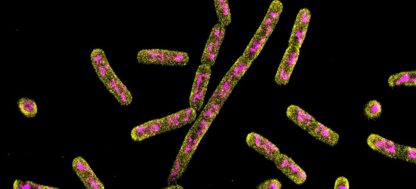 Nanoscopy - Abbelight