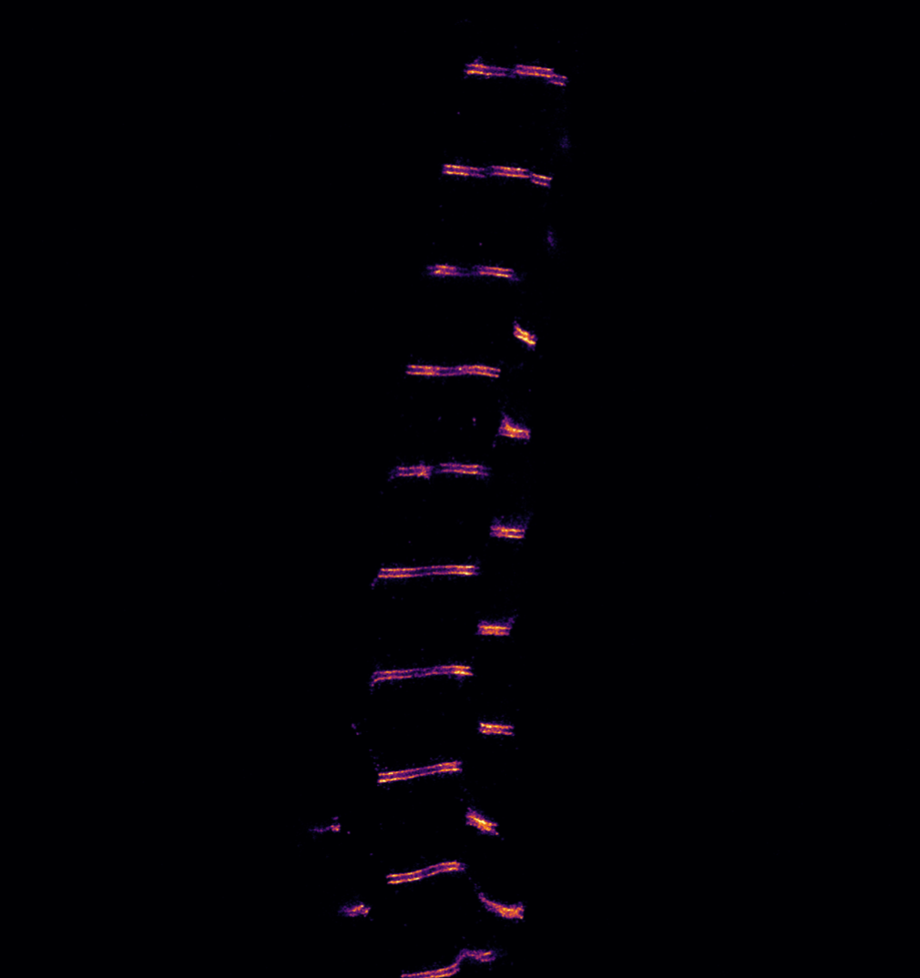Revealing the structure of Sarcomeres - Abbelight